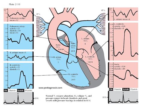 Cardiac Catheterization Pediagenosis