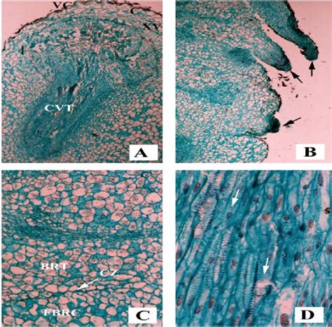 Light Microscope Micrograph Of Root Cross Section Of High Susceptible Download Scientific