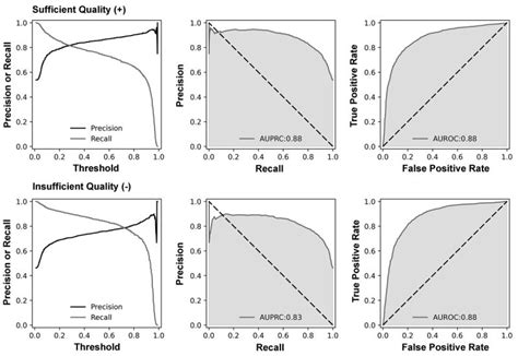 Ophthopedia Update Internal Validation Of A Convolutional Neural Network… Ophthopedia