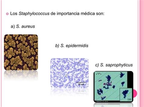 Cultivo Y Aislamiento De Estafilococos De Muestra De 1 Pptx