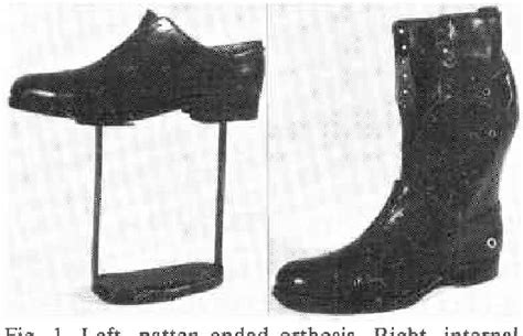 Figure 1 From An Alternative Design Of Extension Prosthesis Semantic