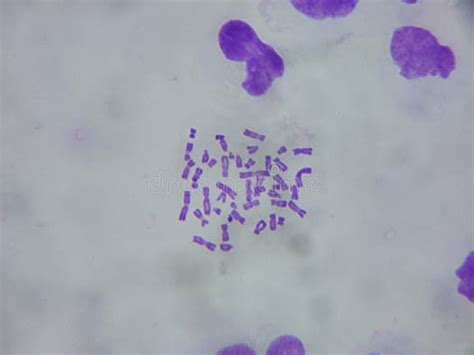 Human Chromosomes Under The Microscope Stock Image Image Of Human