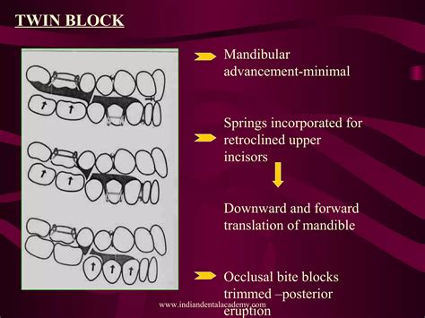 Class 2 Div 2 Malocclusion Ppt