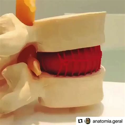 [video] Andrea Lorente Miranda Md Msc Febn Posted On Linkedin