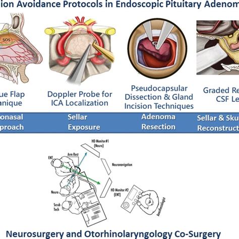 Complication Avoidance Protocols And Operative Suite Setup For