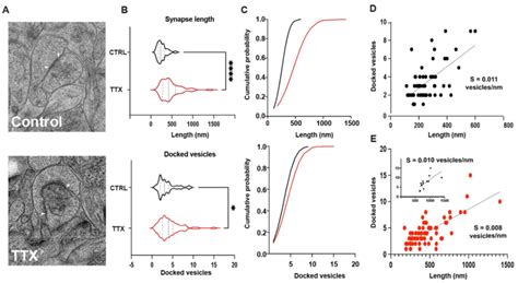 Electron Microscopy Images Show Enlarged Synapses With More Docked