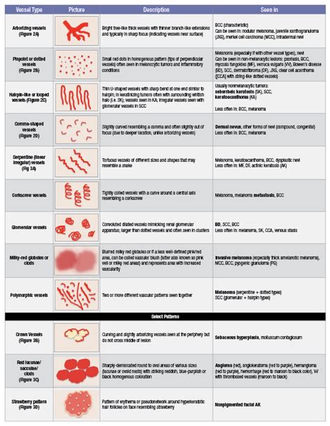 Practical Dermoscopy Part 2 Next Steps In Dermatology
