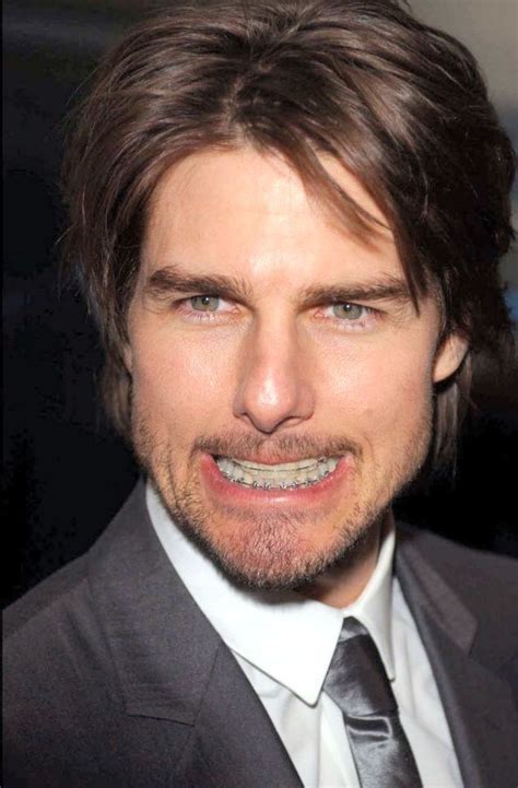 Tom Cruise Teeth Braces Tom Cruise S Middle Tooth The Story Behind