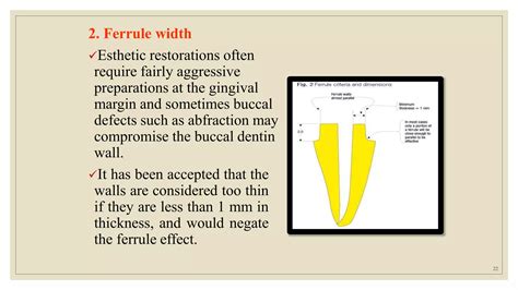 Ferrule Effect Ppsx