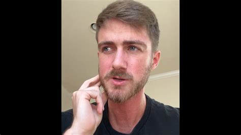 My Severely Misaligned Jaw My Severely Misaligned Body Severe