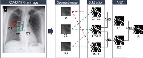 Figure 1 From Chest X Ray Outlier Detection Model Using Dimension