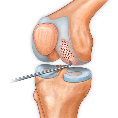 Musculoskeletal Knee Stock Art