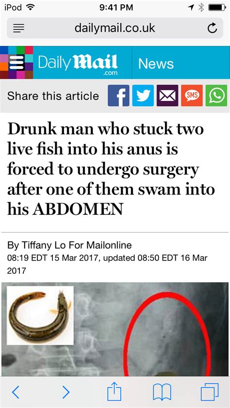 중국 남자 물고기로 자위하다 응급 수술