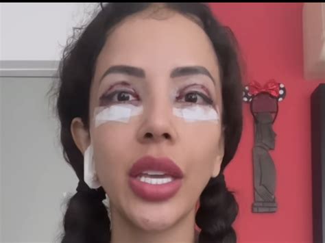 90 Day Fiancé Spoilers Jasmine Pineda Opens Up On Her Eye Surgery Amid