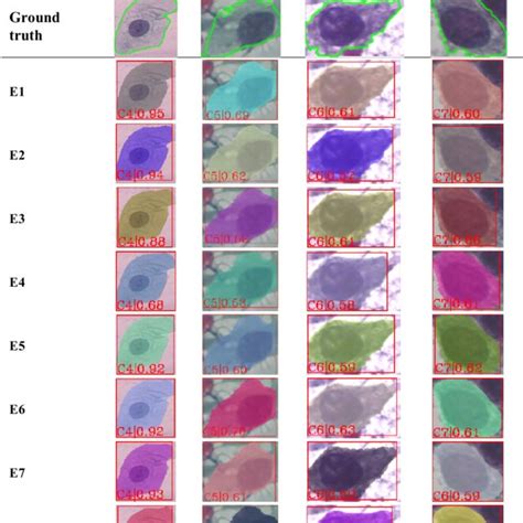 Cell Segmentation Results Of Various Data Augmentation Methods On Download Scientific Diagram