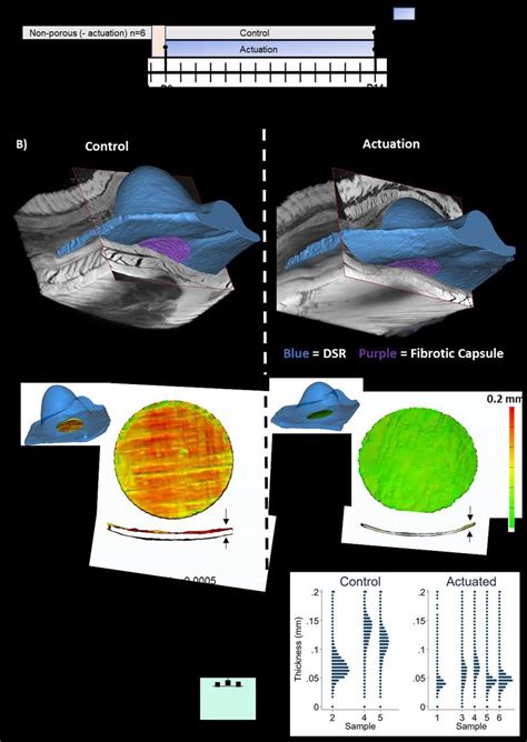 Dsr Reduces The Fibrous Capsule Thickness In Vivo A Timeline For In