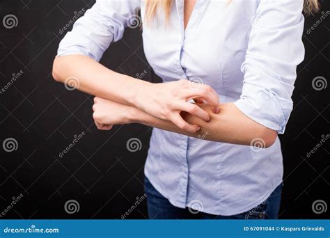 Vrouw Die Een Allergische Reactie Hebben Stock Foto Image Of Dermatologie Intens 67091044