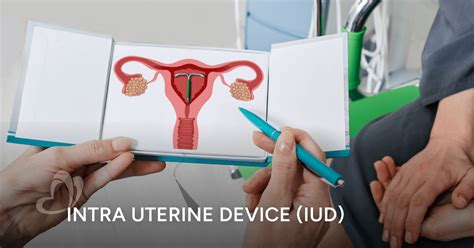 Intra Uterine Device Iud Thomson Medical