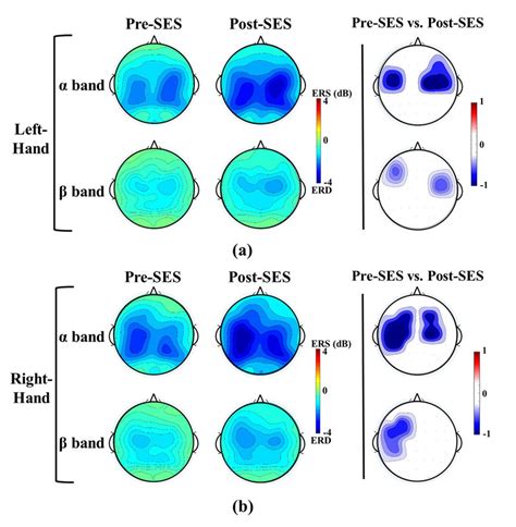 Comparison Of Topographical Activation Patterns Between Pre Ses Block Download Scientific