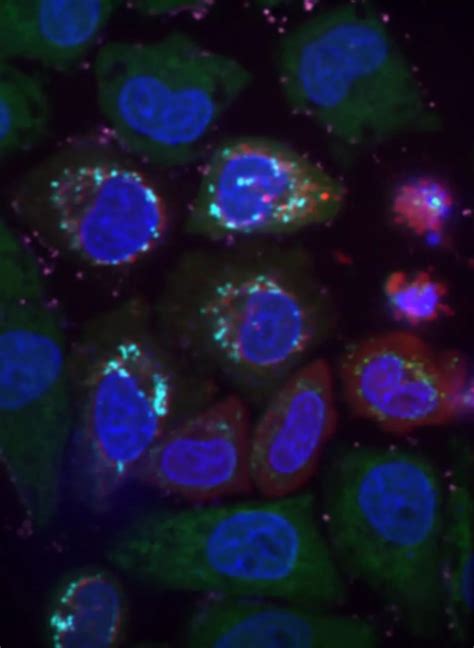 Chemo In A Dish Together By St Jude™