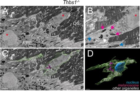 using sbf sem to better understand an eye degeneration disease the amd