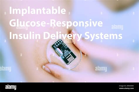implantable glucose responsive insulin delivery systems smart implants