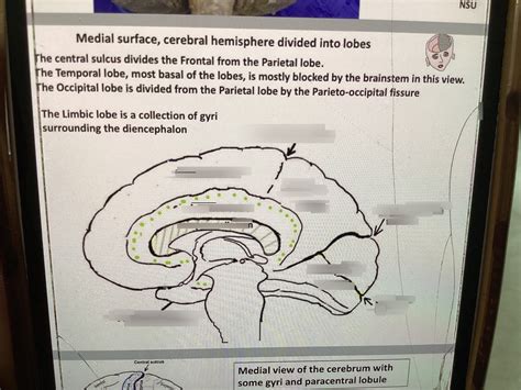 Neuro Practical Diagram Quizlet