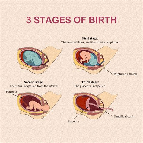 Pregnancy 🤰 3 Stages Of Birth A Quick Guide ⏳ Stage 1 Labor Cervix