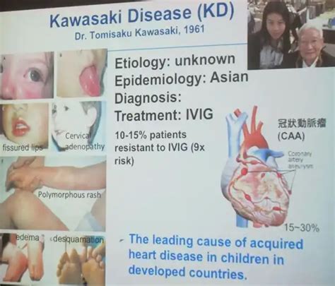 20150420 The Genetics Pathogenesis And Potential Clinical Treatment