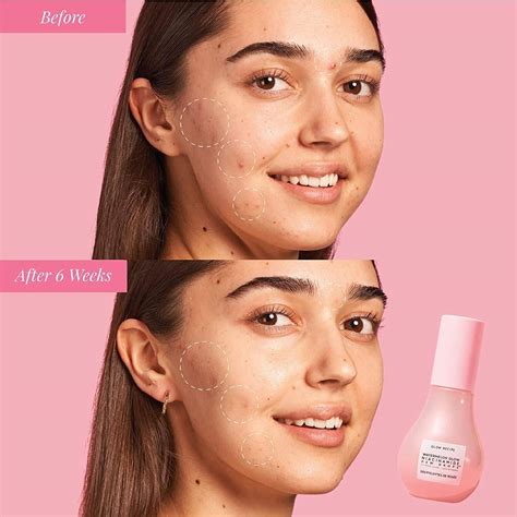 Glow Recipe Watermelon Glow Niacinamide Dew Drops Buy Best Price