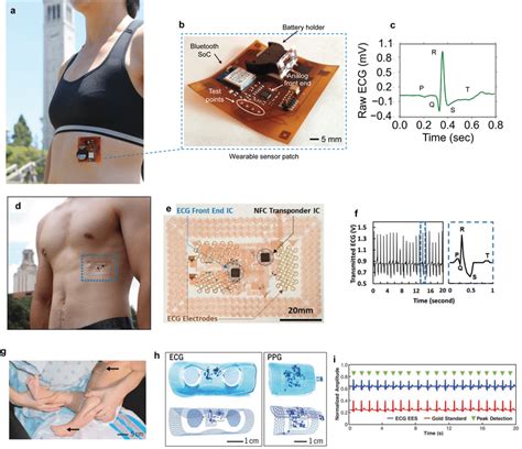 Wearable Fhe Sensor Systems For Monitoring Vital Signs Ab A Wearable