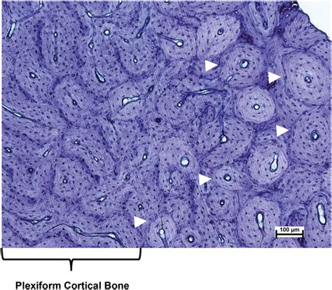 Cortical Bone Histology