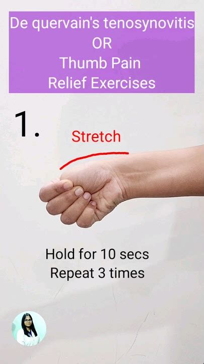 De Quervains Tenosynovitis Physio Exercises Rdvxt