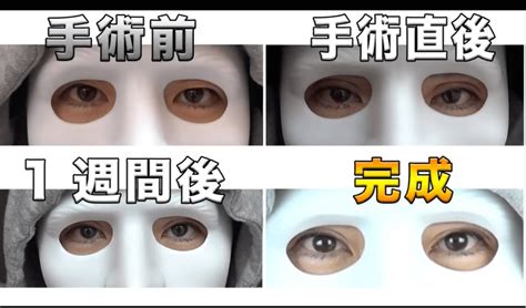 ラファエルの顔写真！フェイク画像が流出したことも。なぜ小出しに公開？ 夢幻のブログ