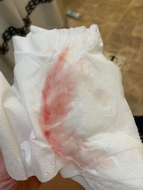 Implantation Bleeding Smell