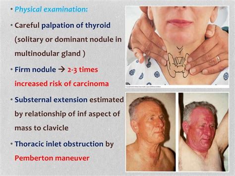 Approach To Thyroid Nodule Pptx Thyroid Disorders Endocrine And