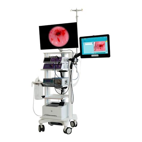 Sistema De Endoscopia Ginecológica Iside Endo Adamo Para Imagens