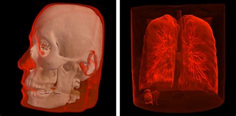 Mri Viewer And Editor
