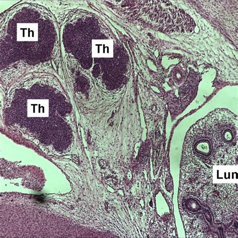Transversal Section Of Human Embryo At The End Of 7 Th Week Th