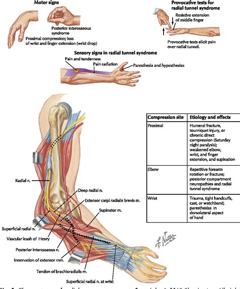 Ulnar Nerve Compression Seryforce