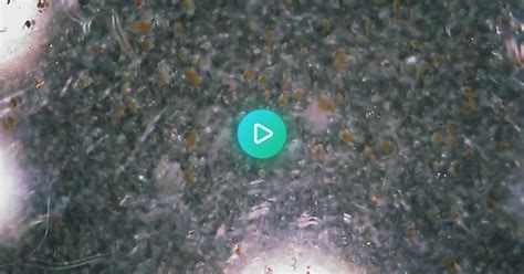 Vinegar Eel Post Extraction  On Imgur