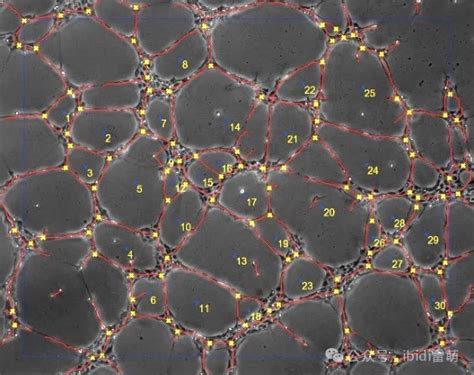 血管生成实验数据怎么分析，这些秘诀您都知道么？