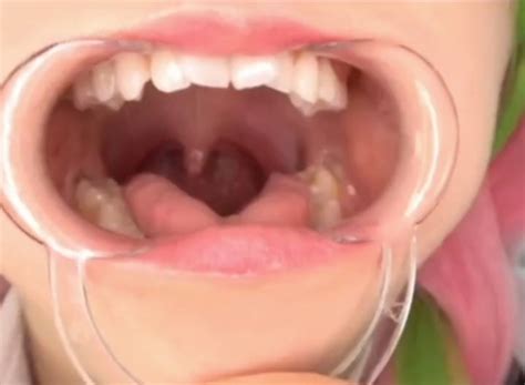 Japanese Girl Uvula Video 5 Japanese Girl Uvula Video 5