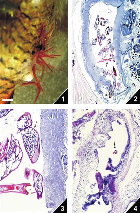Live Camallanus Cotti Adult Worms Protruding From The Anus Of A Beta