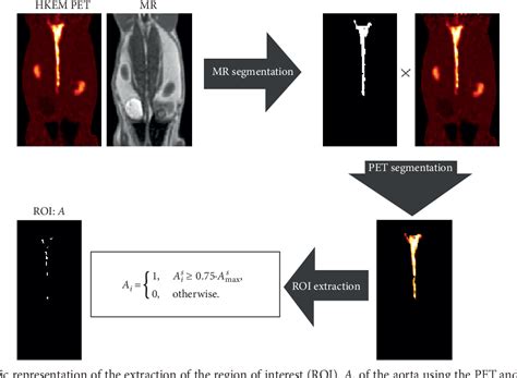 Figure 1 From Hybrid Petmr Kernelised Expectation Maximisation