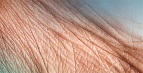 Wrinkle Solutions Natural Wrinkle Treatment