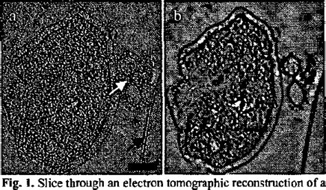 Figure 1 From Segmentation Of Biomedical Images With Eigenvectors Semantic Scholar