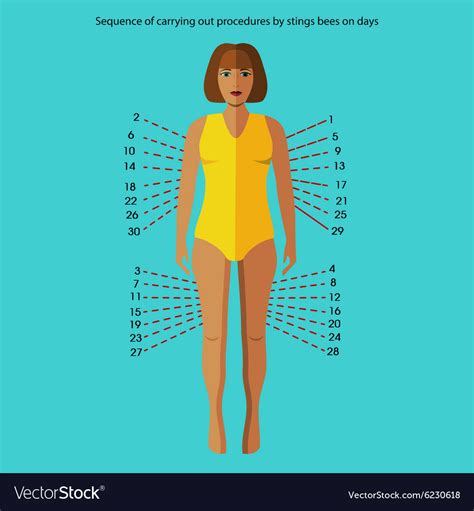 Bee Sting Royalty Free Vector Image Vectorstock