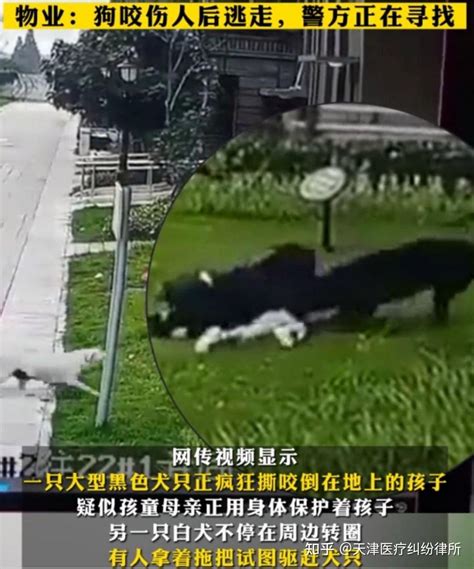 又曝恶犬伤人事件两岁半女童脏器受损！ 知乎