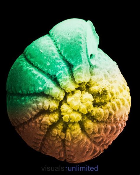 Foraminiferans Are Large Shelled Amoeba With Calcareous Shells